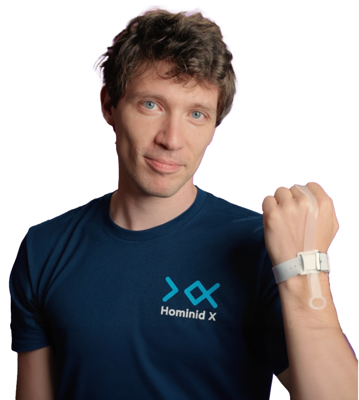 Accelerator Program | Remarkable